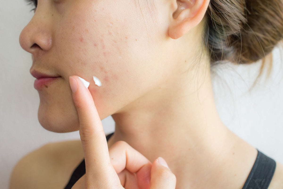 Hydrocortisone cream on face everyday store